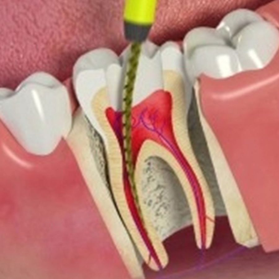 Servicii • Stomatologie Râmnicu Sărat - Dr. State